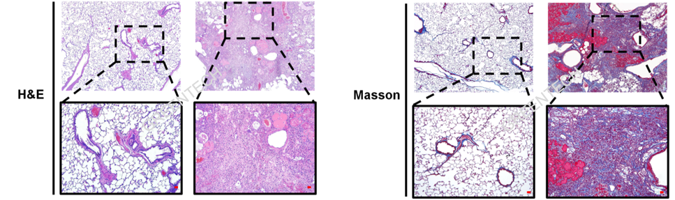 特发性肺纤维化（IPF）模型 - 四川格林泰科 四川格林泰科-临床前研究服务平台